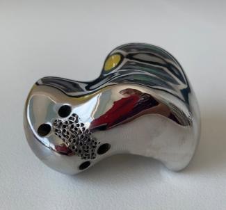 Dr. Toussaint uses 3D printing technology for total talus and ankle ...